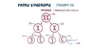 Trisomies Notes: Diagrams & Download PDF | Osmosis