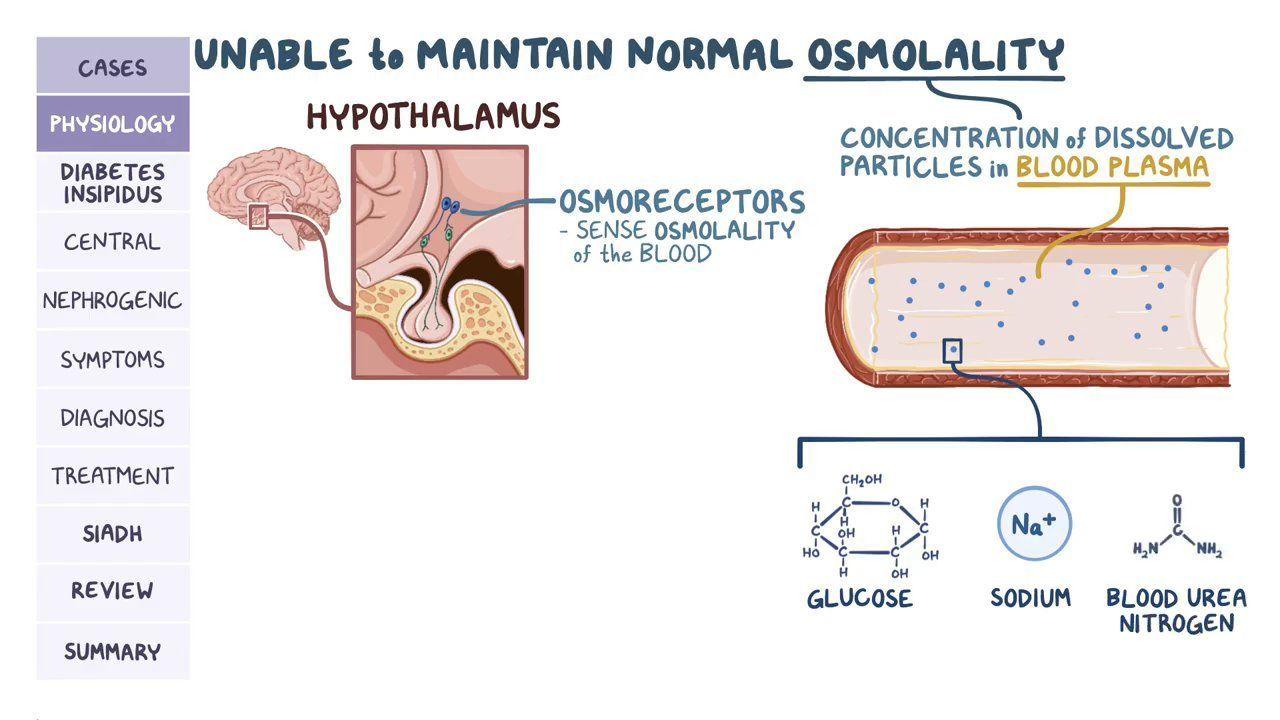Diabetes insipidus and SIADH: Pathology review: Video, Causes ...