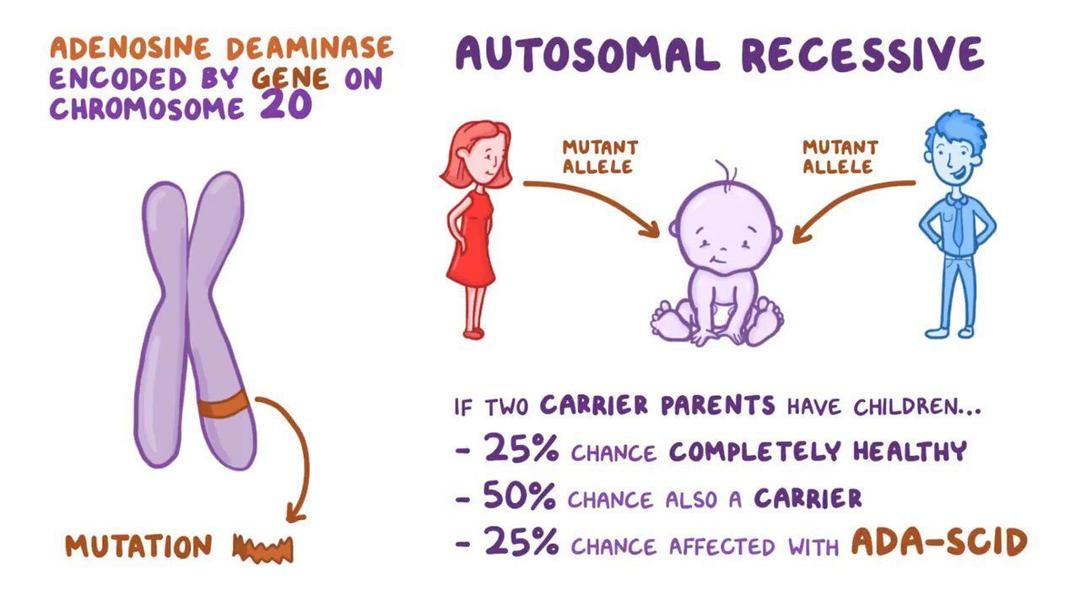 Adenosine deaminase deficiency: Video, Causes, & Meaning | Osmosis