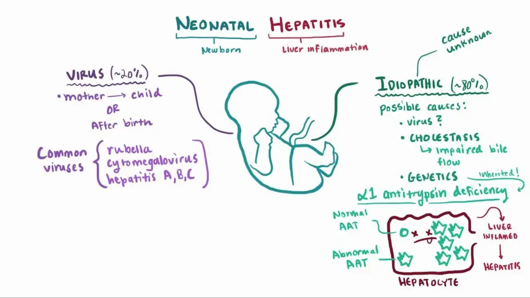 Hepatitis neonatal: Vídeo, Anatomía & Definición | Osmosis