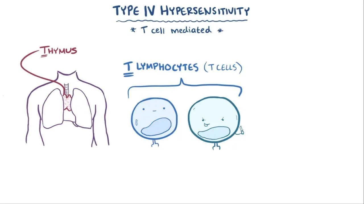 Type IV hypersensitivity: Video, Causes, & Meaning | Osmosis