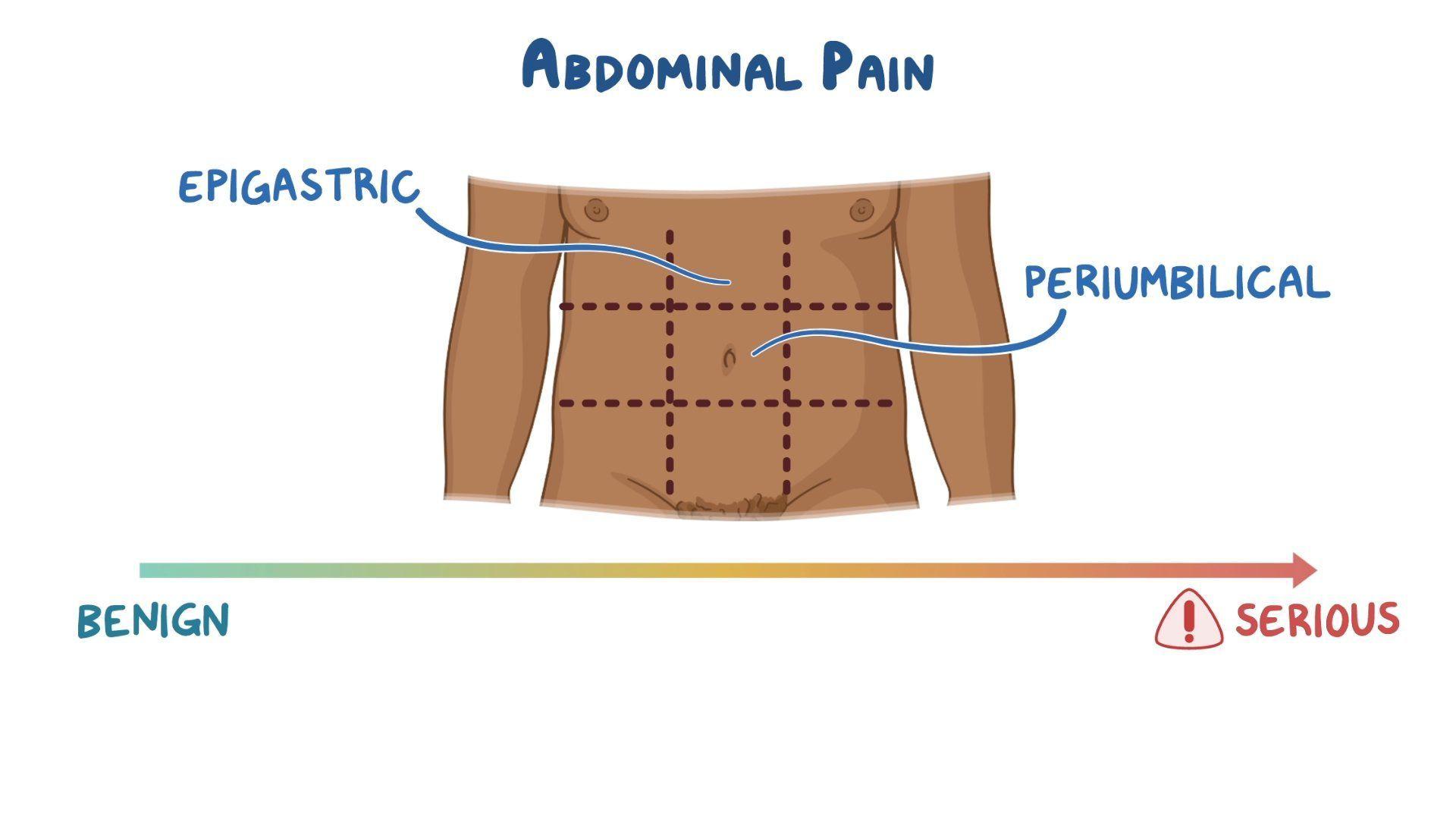 Approach to periumbilical and lower abdominal pain: Video & Meaning ...