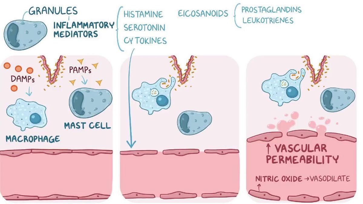 Inflamación: Vídeo, Anatomía, Definición & Función | Osmosis