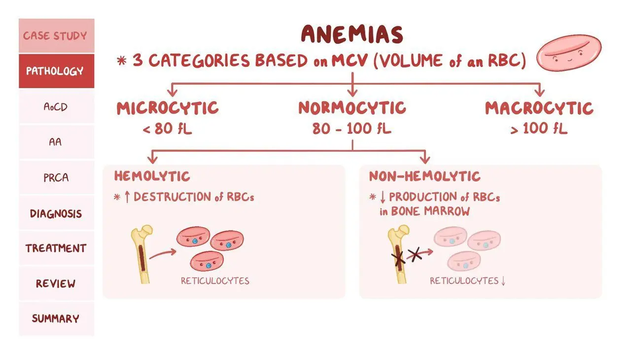 Non-hemolytic normocytic anemia: Pathology review: Video, Causes ...