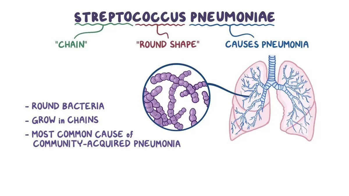 Streptococcus pneumoniae: Video, Causes, & Meaning | Osmosis