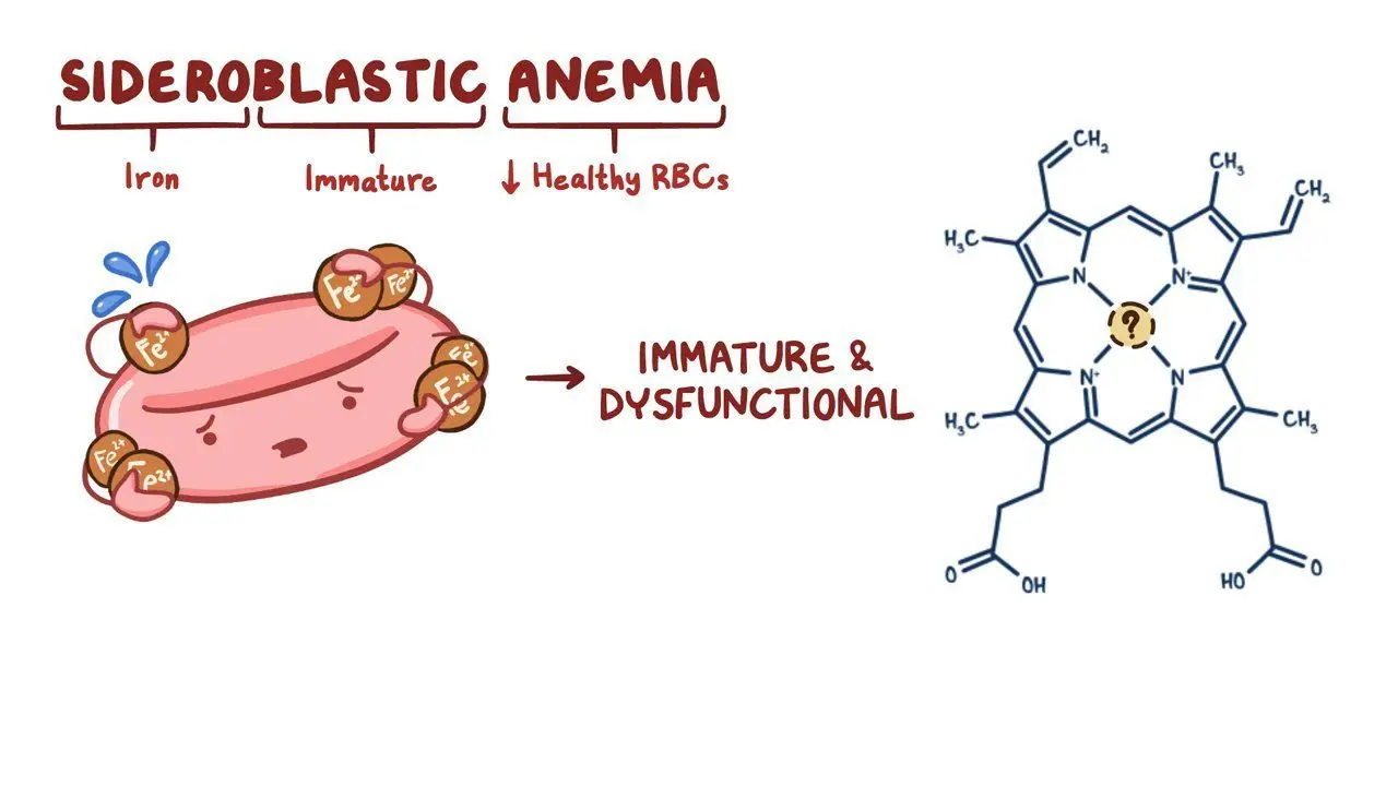 Sideroblastic anemia: Video, Causes, & Meaning | Osmosis