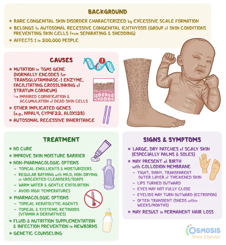 amellar Ichthyosis: What It Is, Causes, Signs and Symptoms, Treatment ...