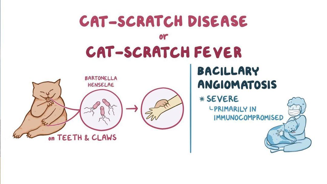 Bartonella henselae (Cat-scratch disease and Bacillary angiomatosis ...