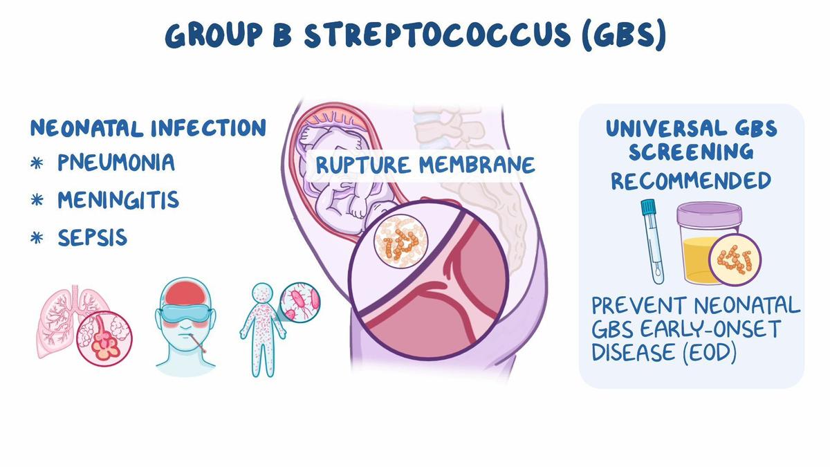 Group B streptococcus (GBS) colonization in pregnancy: Video & Meaning ...