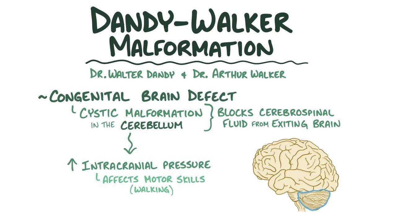 Malformación de Dandy-Walker: Vídeo & Anatomía | Osmosis