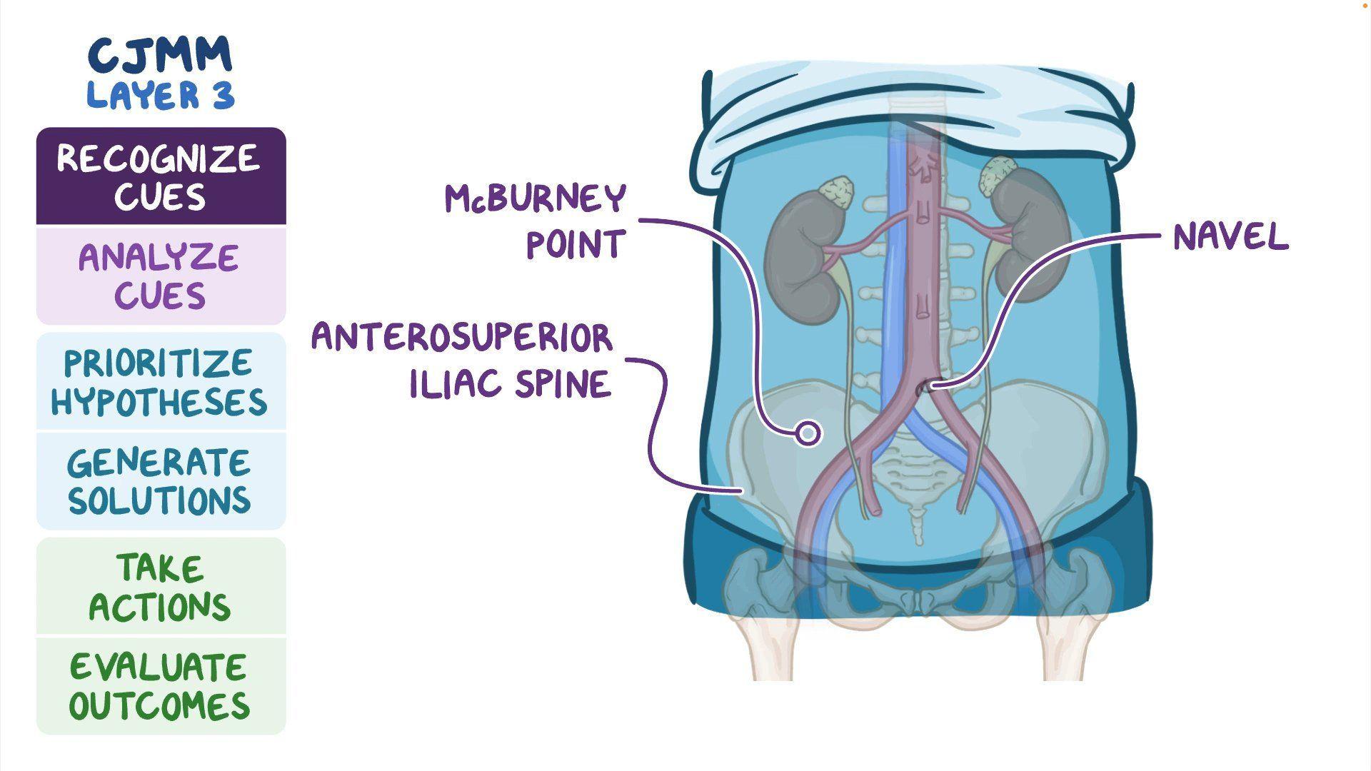 Case study - Pediatric appendicitis: Nursing: Video & Causes | Osmosis