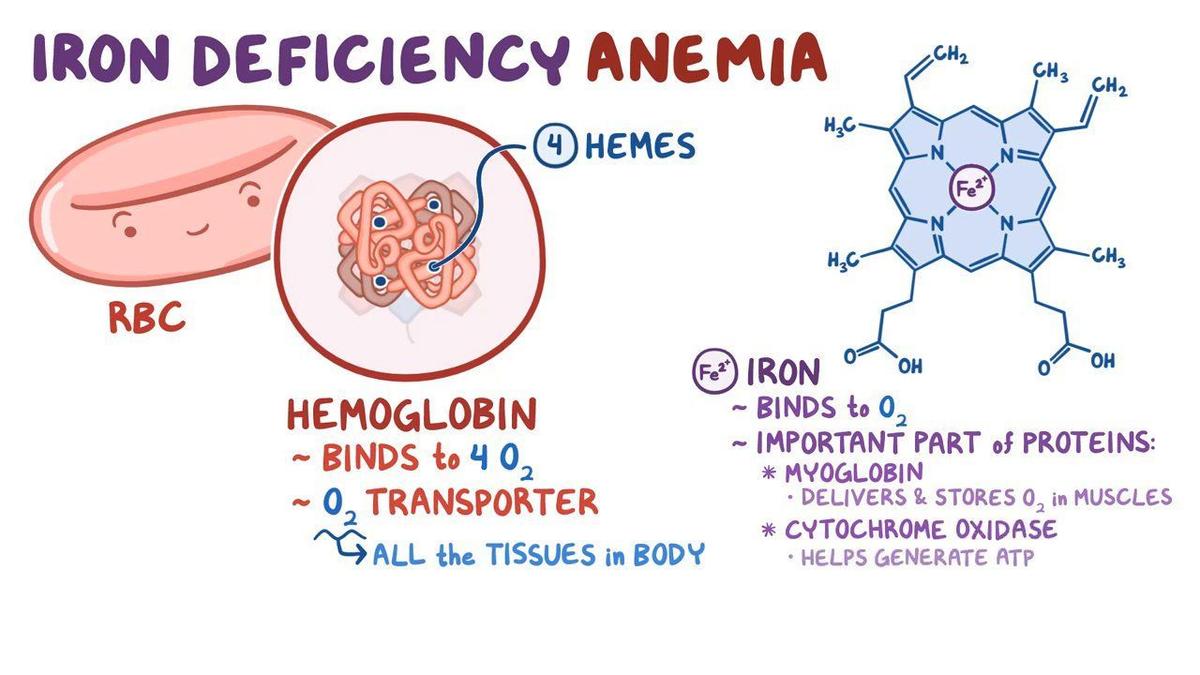 Anemia ferropénica: Vídeo, Anatomía & Definición | Osmosis