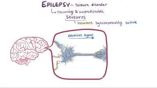 Epilepsy and seizures Notes: Diagrams & Download PDF | Osmosis
