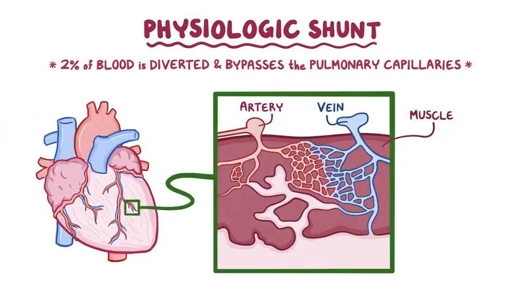 Pulmonary shunts: Video, Causes, & Meaning | Osmosis