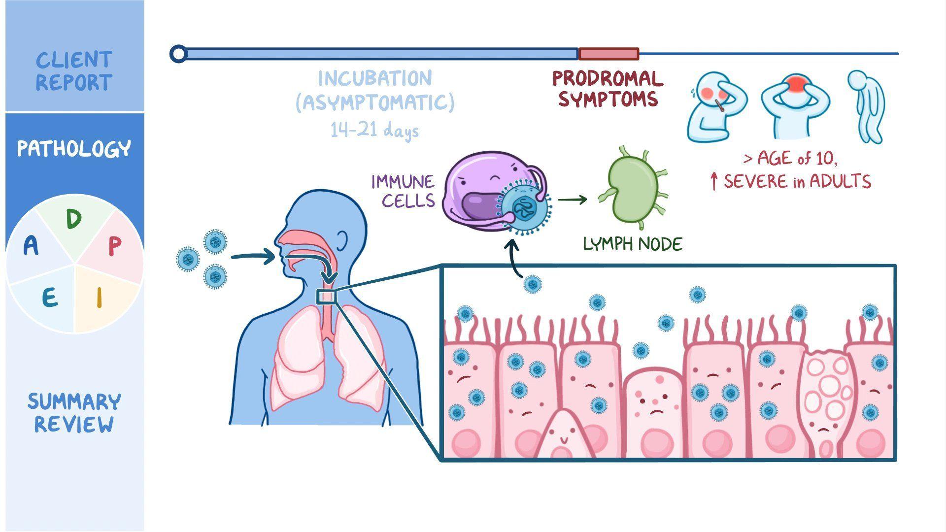 Chickenpox (Varicella): Nursing process (ADPIE): Video, Causes ...