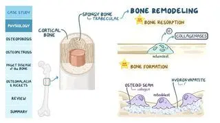 Smith Fracture: What Is It, Difference from Colles, and More | Osmosis