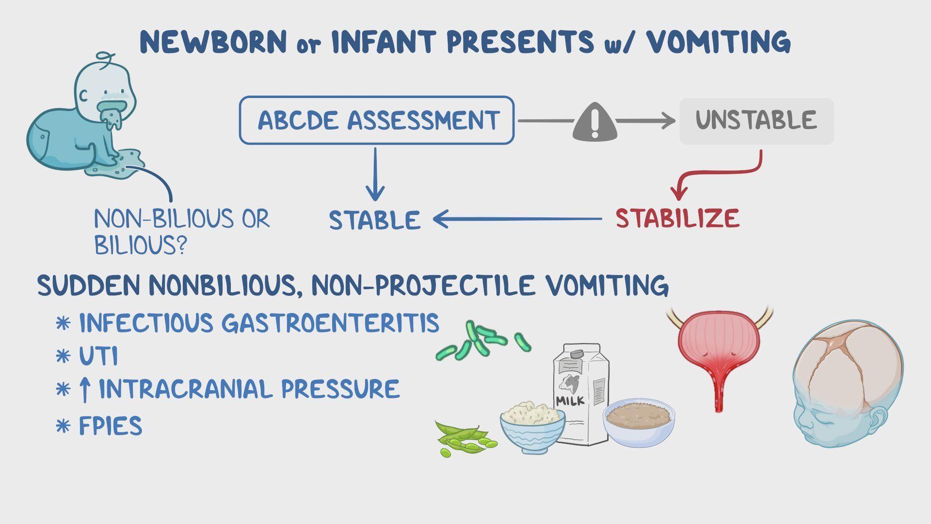 Approach to vomiting (newborn and infant): Video & Meaning | Osmosis