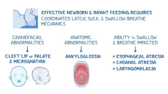 Approach to poor feeding (newborn and infant): Clinical sciences | Osmosis