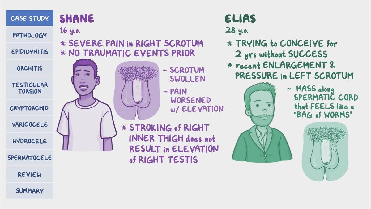 Testicular and scrotal conditions: Pathology review: Video, Causes ...