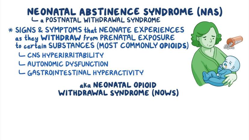 Neonatal abstinence syndrome: Nursing: Video & Causes | Osmosis