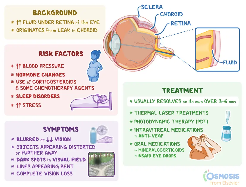 Central Serous Retinopathy: What It Is, Causes, Signs and Symptoms ...