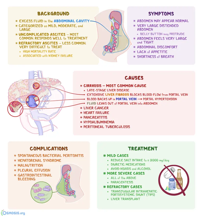 Ascites: What Is It, Causes, Appearance, Treatment, and More | Osmosis
