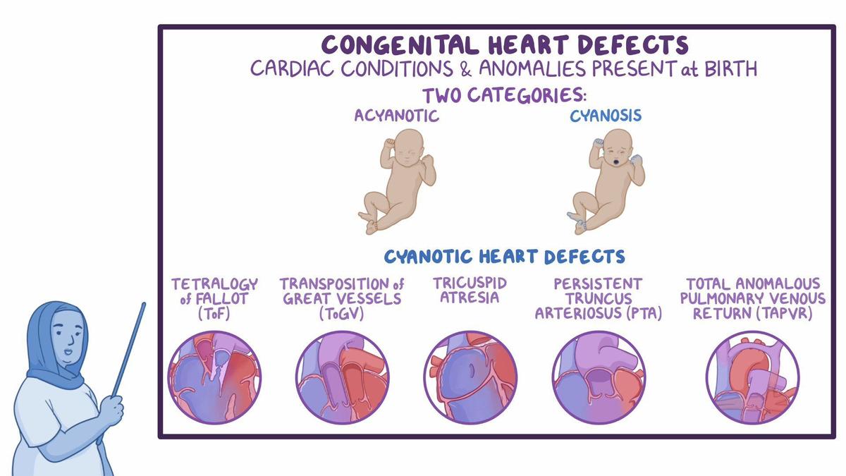 Video: Congenital heart defects - Cyanotic: Nursing | Osmosis