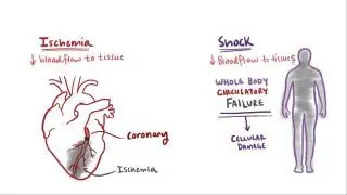 Shock Notes: Diagrams & Download PDF | Osmosis