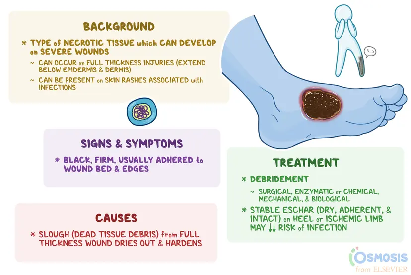 Eschar: What It Is, Causes, Treatment, and More | Osmosis
