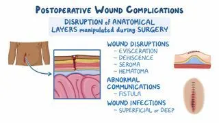 Dermoid Cysts: What Are They, Causes, Treatment, and More | Osmosis