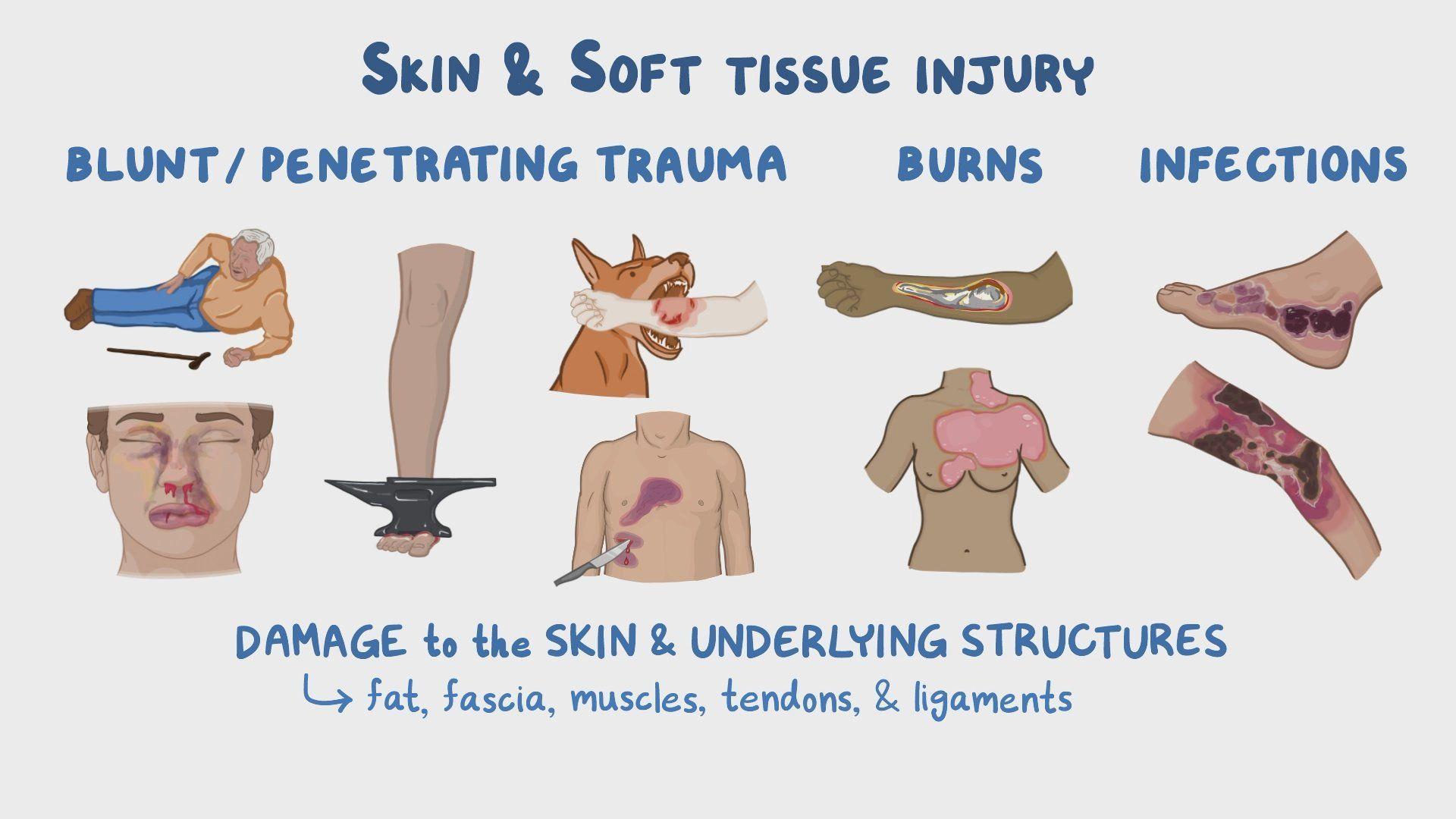 Approach to skin and soft tissue injury: Video & Meaning | Osmosis