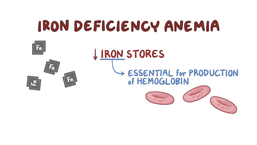 Anemia - Iron-deficiency: Nursing: Video & Causes | Osmosis