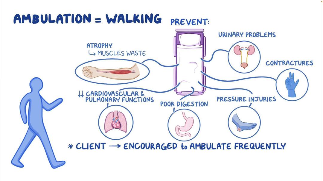 Mobility - Ambulation: Nursing skills: Video, Causes, & Meaning | Osmosis