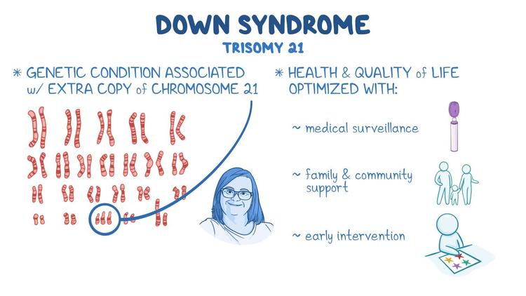 Approach to a child with Down syndrome (trisomy 21): Video & Meaning ...