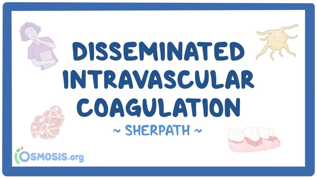 Video Case Study - Disseminated Intravascular Coagulation: Video ...