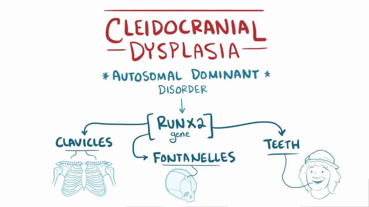 Cleidocranial dysplasia: Video, Causes, & Meaning | Osmosis