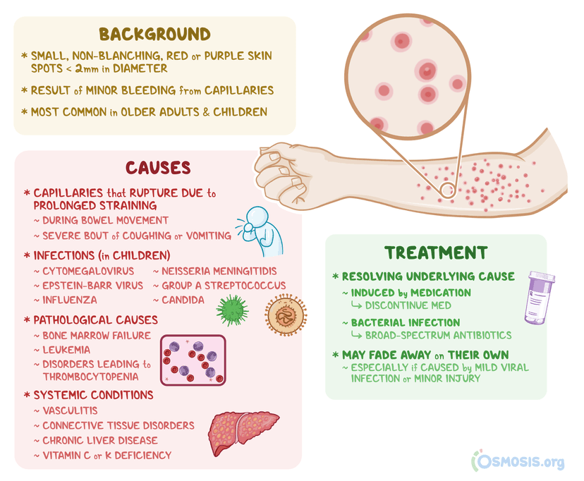 Petechiae, Rash on Face, Worries and Causes | Osmosis