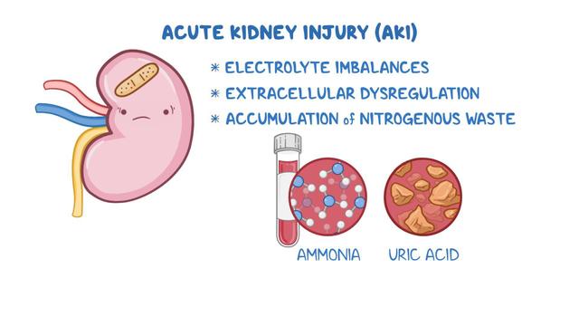 Approach to acute kidney injury: Video & Meaning | Osmosis