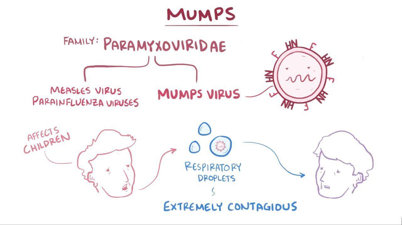 Virus de la parotiditis: Vídeo, Anatomía & Definición | Osmosis