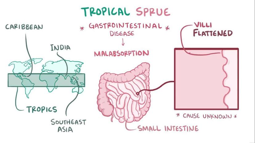 Tropical sprue: Video, Causes, & Meaning | Osmosis