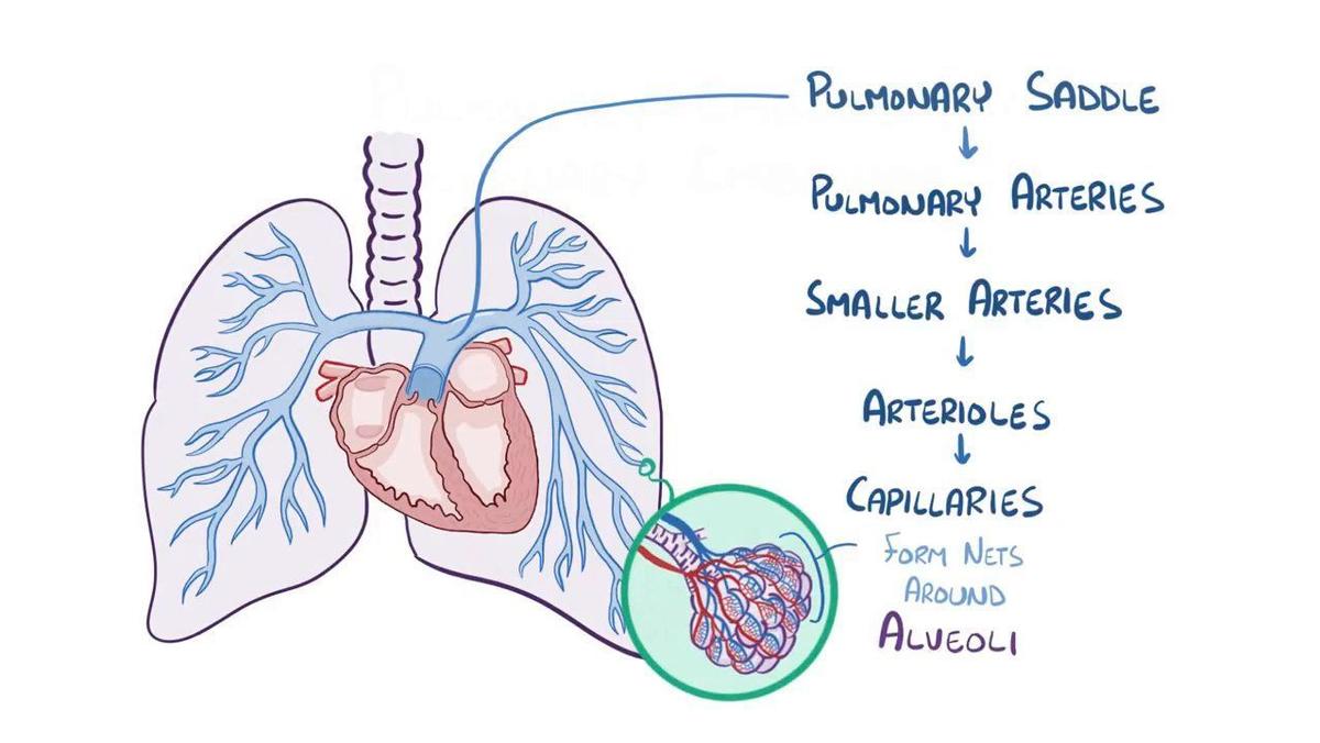 Pulmonary embolism: Video, Causes, & Meaning | Osmosis
