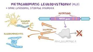 Sphingolipidoses Notes: Diagrams & Download PDF | Osmosis