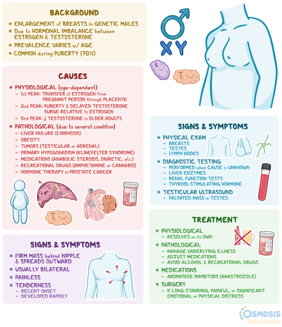 Gynecomastia: What Is It, Causes, Signs and Symptoms, Treatment | Osmosis