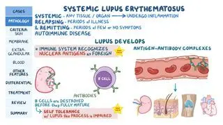 SOAP BRAIN MD: Lupus Diagnostic Criteria Acronym | Osmosis