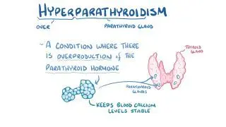 Hyperparathyroidism and hypoparathyroidism Notes: Diagrams & Download ...