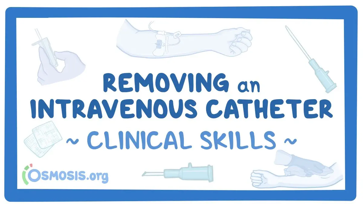 Removing an intravenous line: Video, Causes, & Meaning | Osmosis