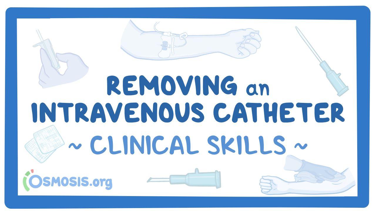 Removing an intravenous line: Video, Causes, & Meaning | Osmosis