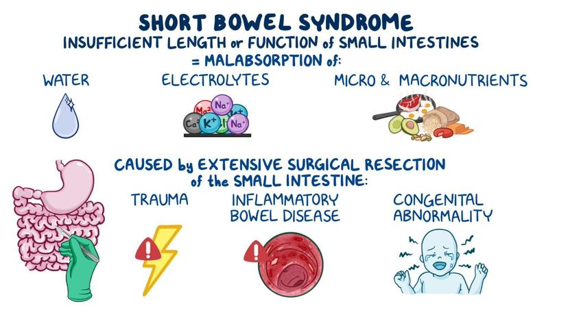 Short bowel syndrome: Video & Meaning | Osmosis