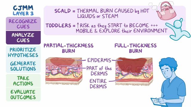 Case study - Burn (pediatric): Nursing: Vídeo | Osmosis