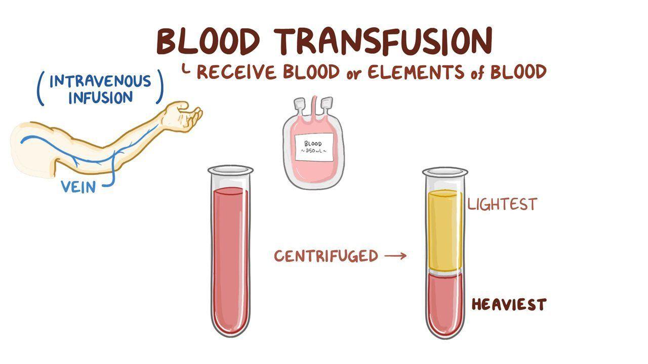 Blood groups and transfusions: Video, Causes, & Meaning | Osmosis